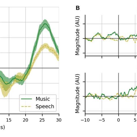 General Music And Speech Evoked Abr Waveforms Using The Anm As The