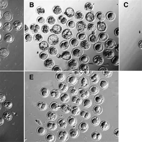 Requirement Of The Oocyte Nucleolus For The Early Step Of Pronucleus Download Scientific
