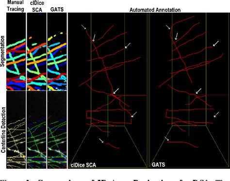 Improved Topological Preservation In 3d Axon Segmentation And Centerline Detection Using