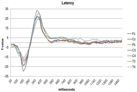 This Graph Shows The Result Of The P2 Latency Variable Of The Post Hoc