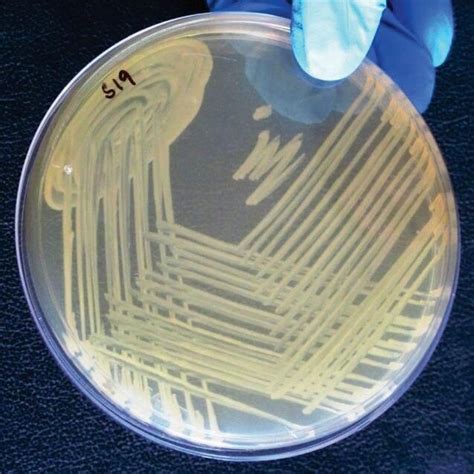 B Culture Of Brucella Abortus Strain Rb51 Organisms Download Scientific Diagram