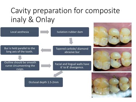 Indirect Composite Restorations Pptx