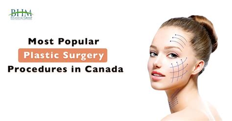 Best Plastic Surgery Procedures In Canada
