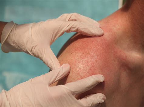 N N L M G Khi B D Ng Da