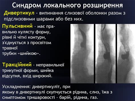 Променева діагностика захворювань шлунково кишкового тракту презентация онлайн