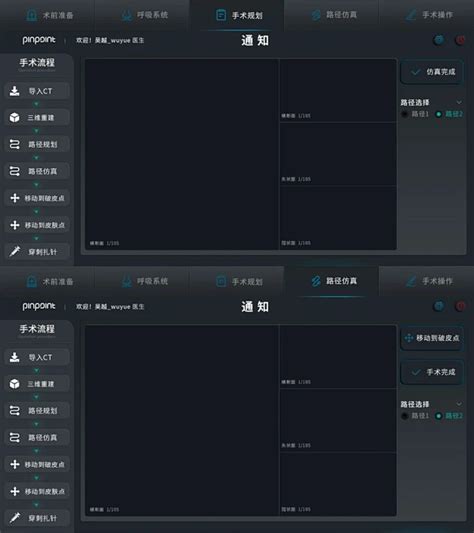 医疗器械手术ct设备仪器操作软件ui界面设计 小红书 花瓣网