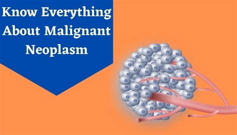 Malignant Neoplasm Symptoms Causes And Treatment Livlong