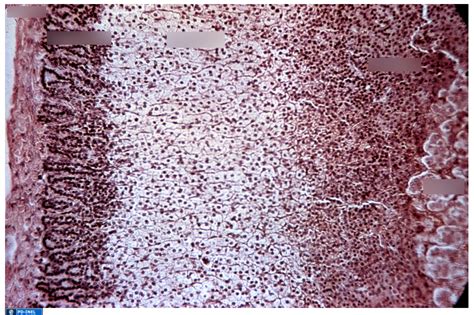 Adrenal Cortex Diagram Quizlet