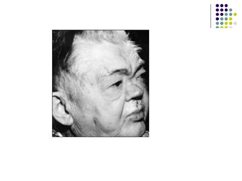 16 Hypo And Hyperthyroidism Ppt