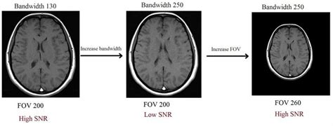 Mri Bandwidth And Image Quality How To Manipulate Transmitter Bandwidth And Receiver Bandwidth