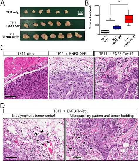 The Overexpression Of Twist1 In Esophageal Normal Fibroblasts Enhanced