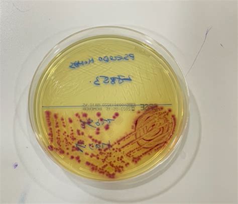 Urochrome Agar Showing Growth Of E Coli Download Scientific Diagram