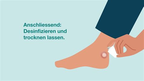 Impuls Was Tun Bei Blasen An Den Füssen Youtube