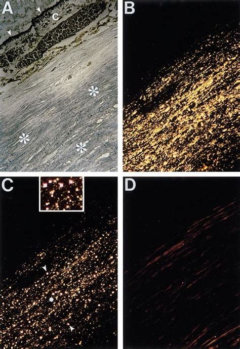 A Section Demonstrating Sudan Black Staining Of The Rpe Arrowheads Download Scientific
