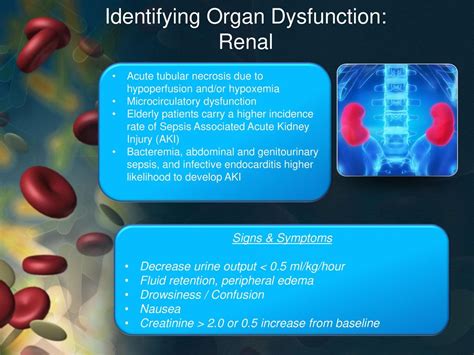 sepsis ppt download