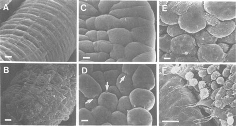 A D Shows The Abnormal Morphology Of Tissues Of Mesodermal And Download Scientific Diagram