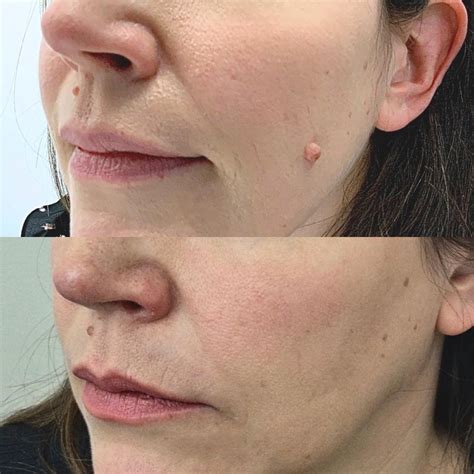Minor Skin Irregularities — Nu Image Medical Esthetics