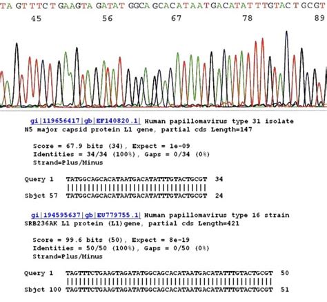Genotyping Distinction Between Hpv 16 And Hpv 31 May Need A 50 Base