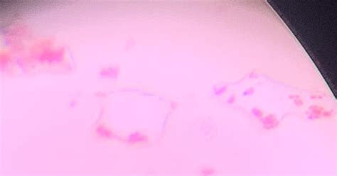 Gram Staining On Deinococcus Aquaticus