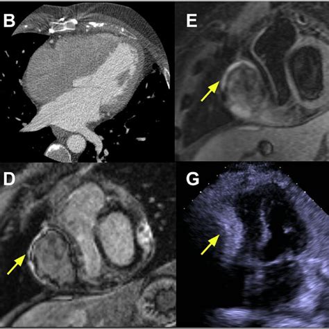 Multimodality Comparative Imaging Download Scientific Diagram