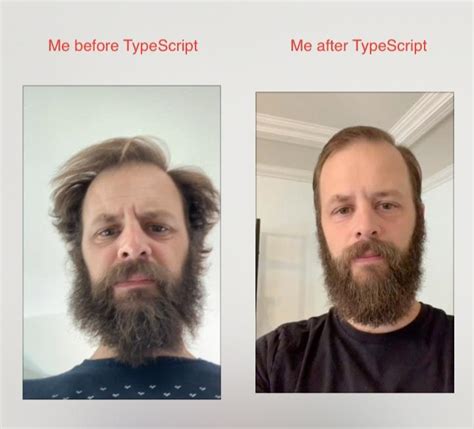 Saeed Ahmed 🖋 On Linkedin Typescript 😍