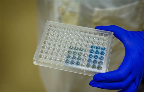 Dopamine Elisa Kit Ultra Sensitive Any Sample Gentaur Distribution Us Uk And Europe