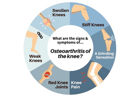 Knee Osteoarthritis Stages Causes And Path To Pain Free Life