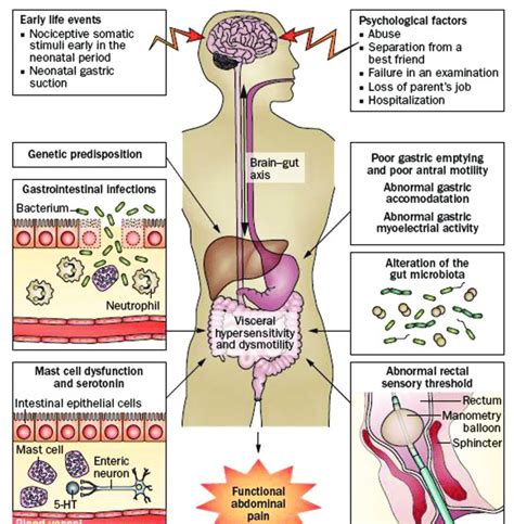 What Are Abdominal Spasms With Pictures