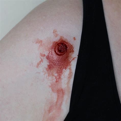 Gunshot Entry Wound 2 Prosthetic Appliance Encapsulated Silicone