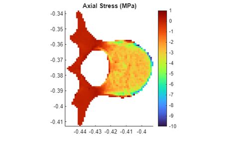 Medical Image Based Finite Element Analysis Of Spine Matlab