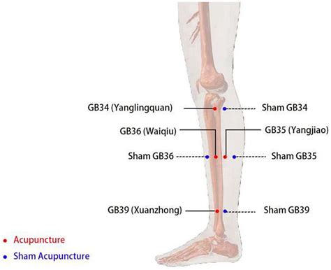 Efficacy Of Acupuncture At Sensitized Acupoints Versus Sham Acupunctur