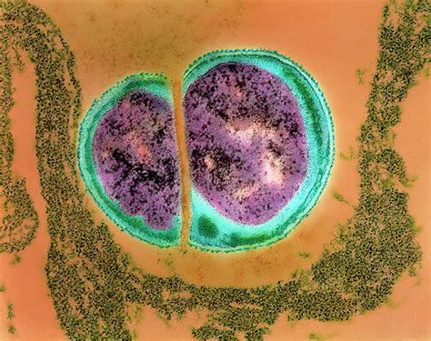 Otitis Photographs Fine Art America