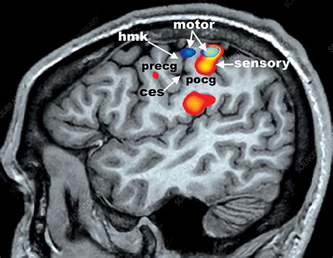 Sensory And Motor Task Fmri Stock Image C0366047 Science Photo