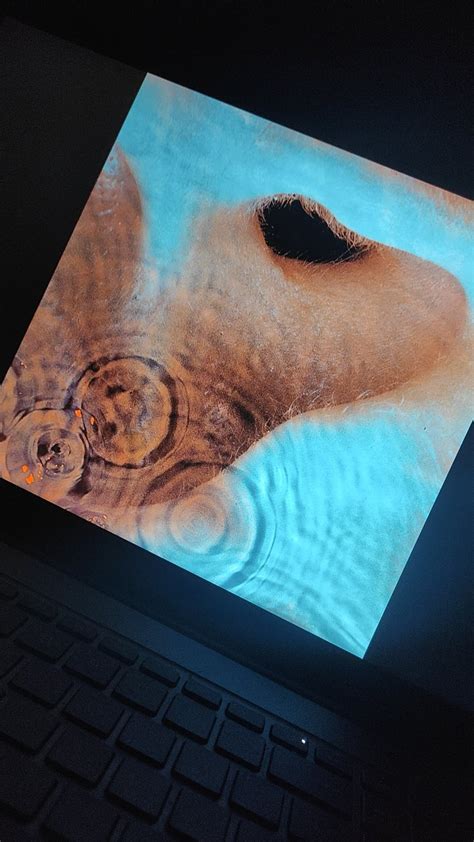 Extremely Recommended For Trip Echoes Pink Floyd Rlsdtriplifehacks