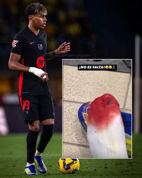 ბარსელონას ქართული ფანკლუბი ️👀 ლამინე იამალის ინსტაგრამ ‘სთორი “ეს არ არის ჯარიმა 😂” Facebook