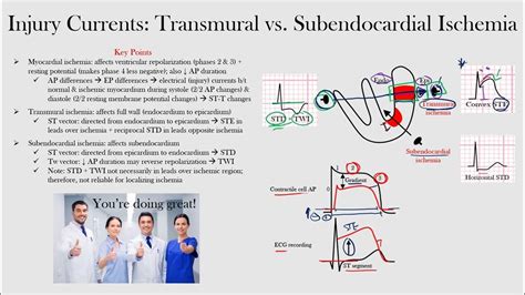 Transmural Vs Subendocardial Ischemia Youtube