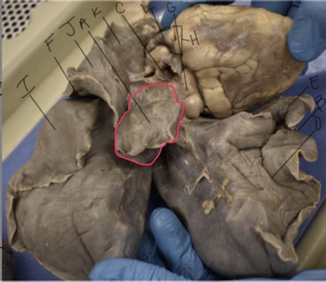 Anatomy Lab Exam 3 Sheep Pluck Flashcards Quizlet