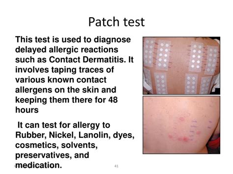 Ppt Antibody Mediated Cytotoxicity Type Iihypersensitivity 3