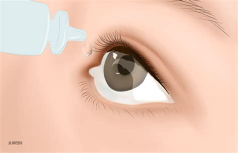 6种常用滴眼液功效解读 好医术文章 好医术 赋能医生守护生命