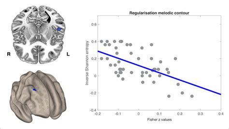 seed to voxel regression analysis was conducted over the whole brain