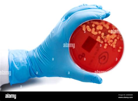 Cultured Streptococcus Bacteria Haemolytic Streptococcus Sp Lancefield Group C Bacteria