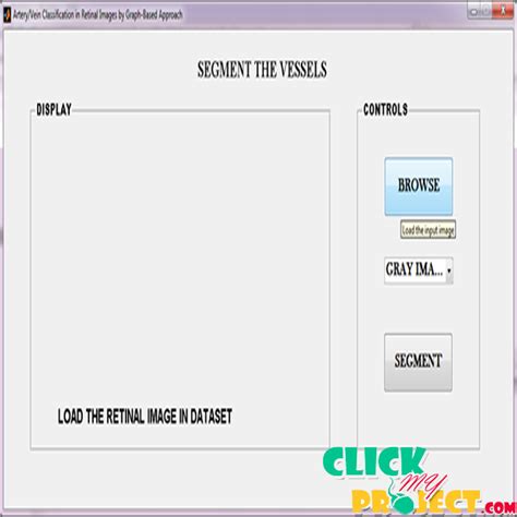 An Automatic Graph Based Approach Forartery Vein Classification In Retinal Images Clickmyproject