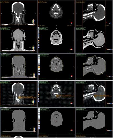 Graphical Representation Of Accuray Dir Process The First Row Shows Download Scientific