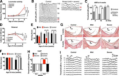 Hyperactivity Induced By Inner Ear Dysfunction Is Coincident With Download Scientific Diagram