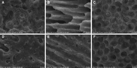 Scanning Electron Microscopic Sem Observation On Enterococcus