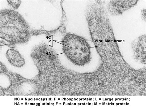 Measles Virus Under Microscope