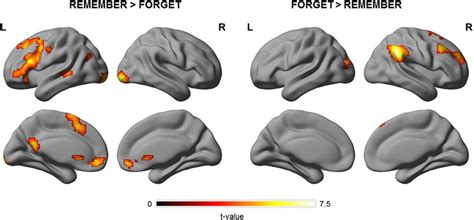 Whole Brain Statistical Parametric Maps Representing Brain Activation
