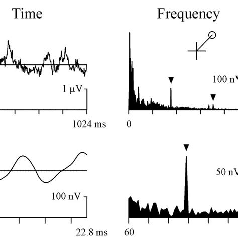 Recording Auditory Steady State Responses This Figure Shows How The Download Scientific