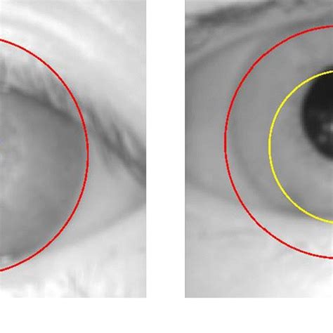 two examples of iris localization using integro differential operator