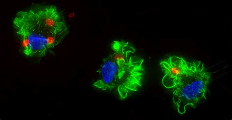 Toxoplasma Image Eurekalert Science News Releases
